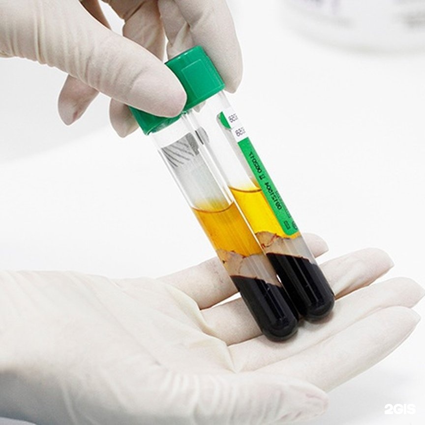 Τι είναι PRP | Athens Dental Implant Center